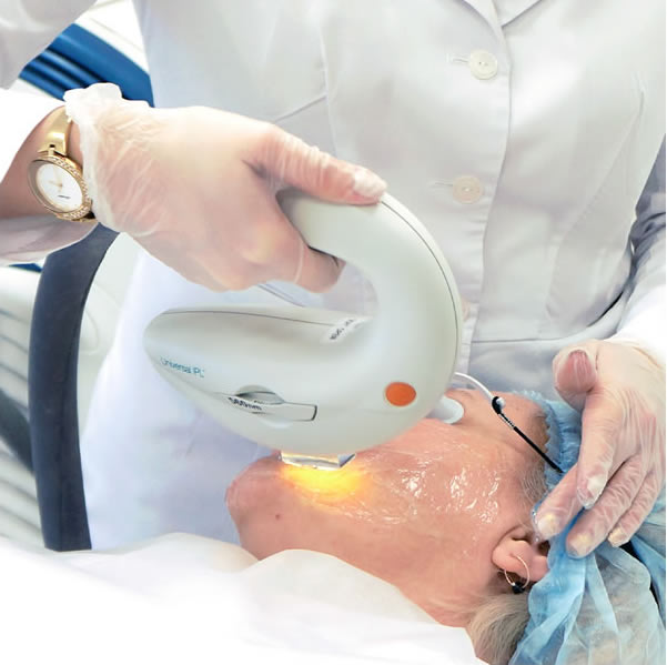 IPL-терапия на аппарате M22 Lumenis в клинике "Градиент"