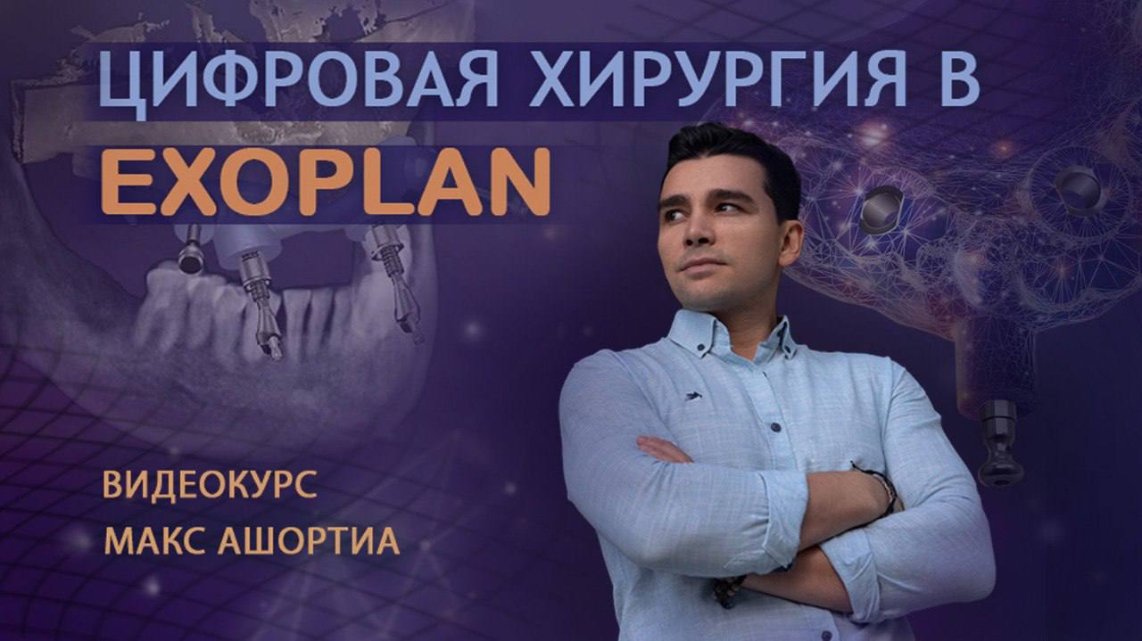 Цифровая хирургия в Exoplan (экзоплан)