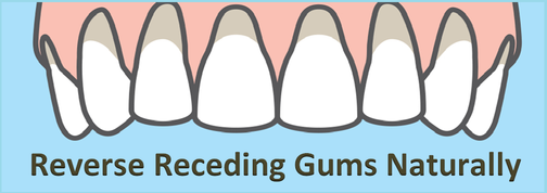 How To Reverse Receding Gum Line Naturally?