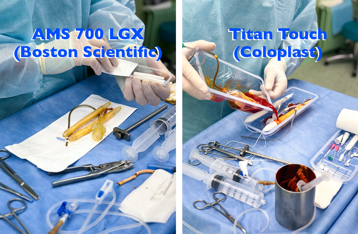 Сравнение протезов полового члена AMS 700 LGX и Coloplast Tiтan Touch