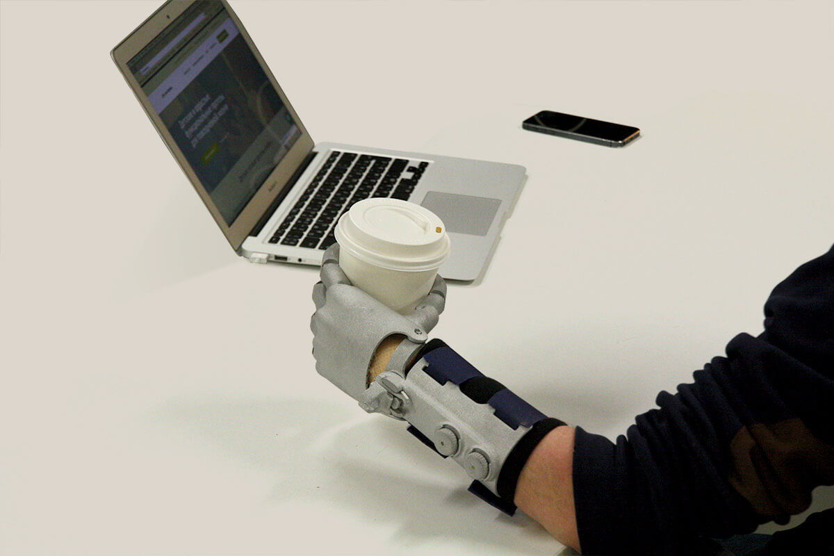 Prosthetic arm - Cybi Fingers