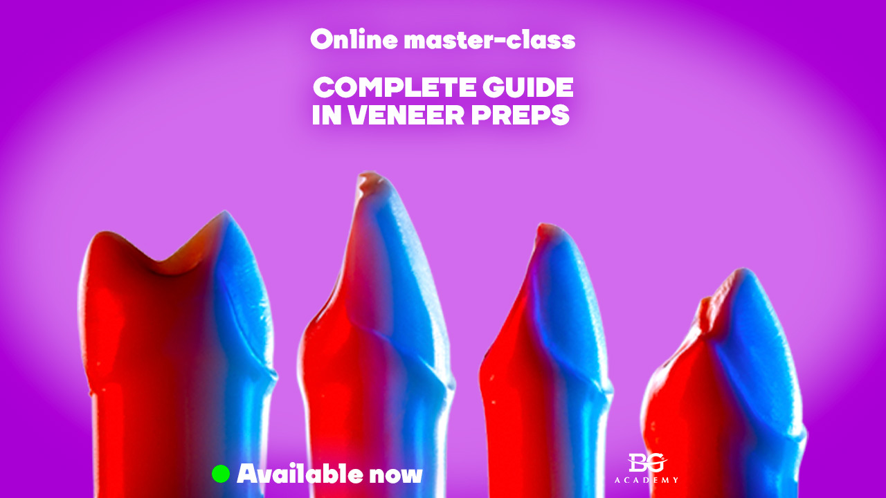 Complete guide in veneer preps. All types.