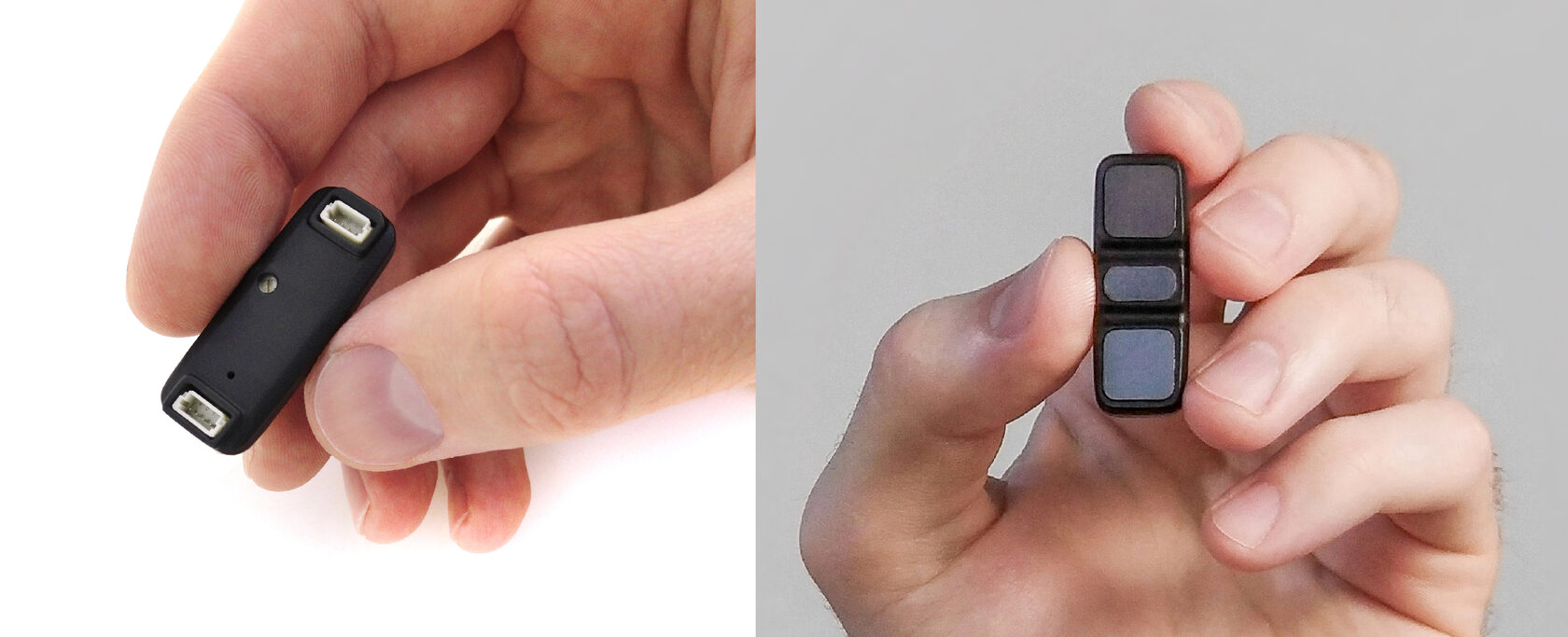 Electromyogram. What it it?