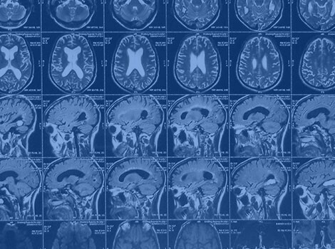 МРТ головы в Волгограде | Центр диагностики Sity