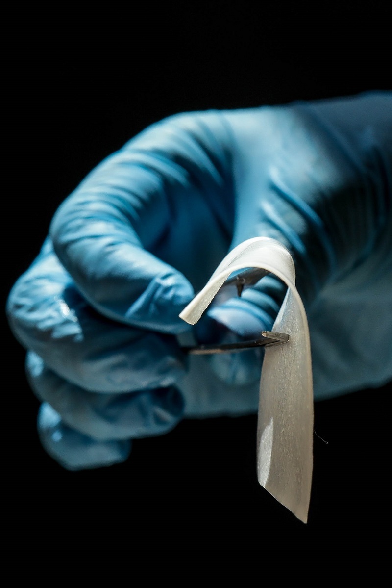 Biological prosthesis of dura mater “xenoDURA”