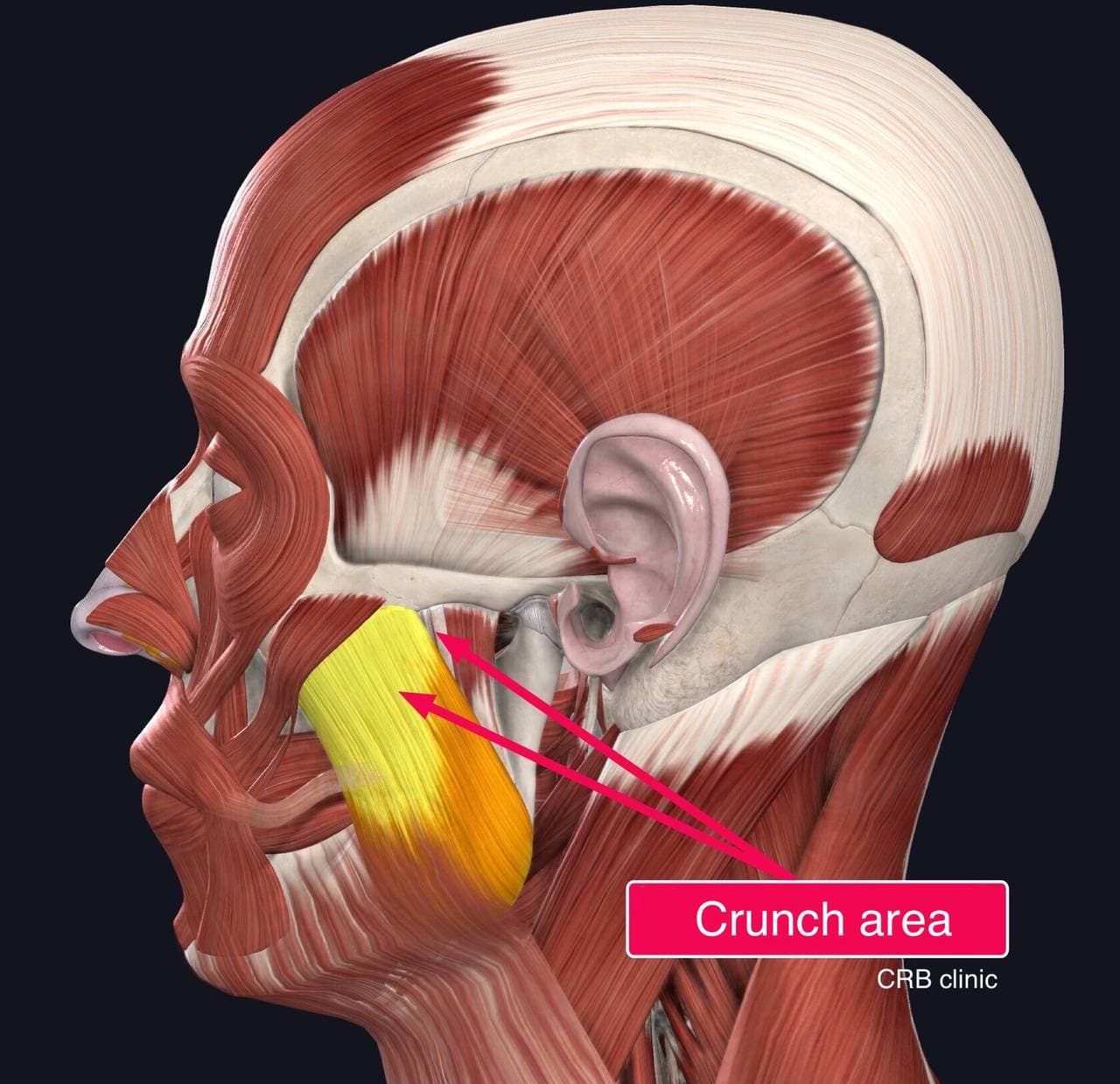 Crunch in the jaw joint. Treatment at CRB clinic