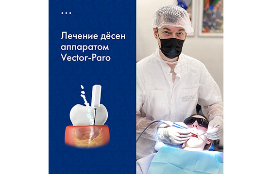 Лечение пародонтита апаратом Vector Paro - стоматология Time to Smile ...