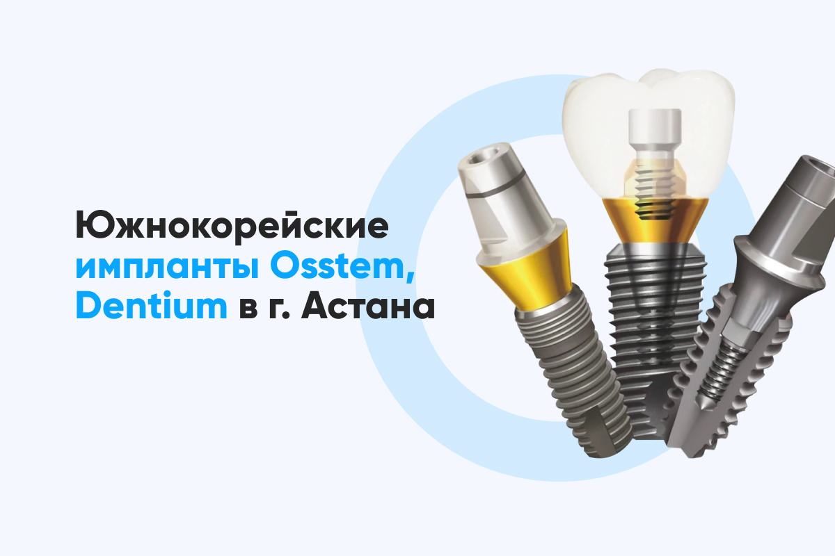 Южнокорейские импланты Osstem, Dentium в Астане | Bas Dent