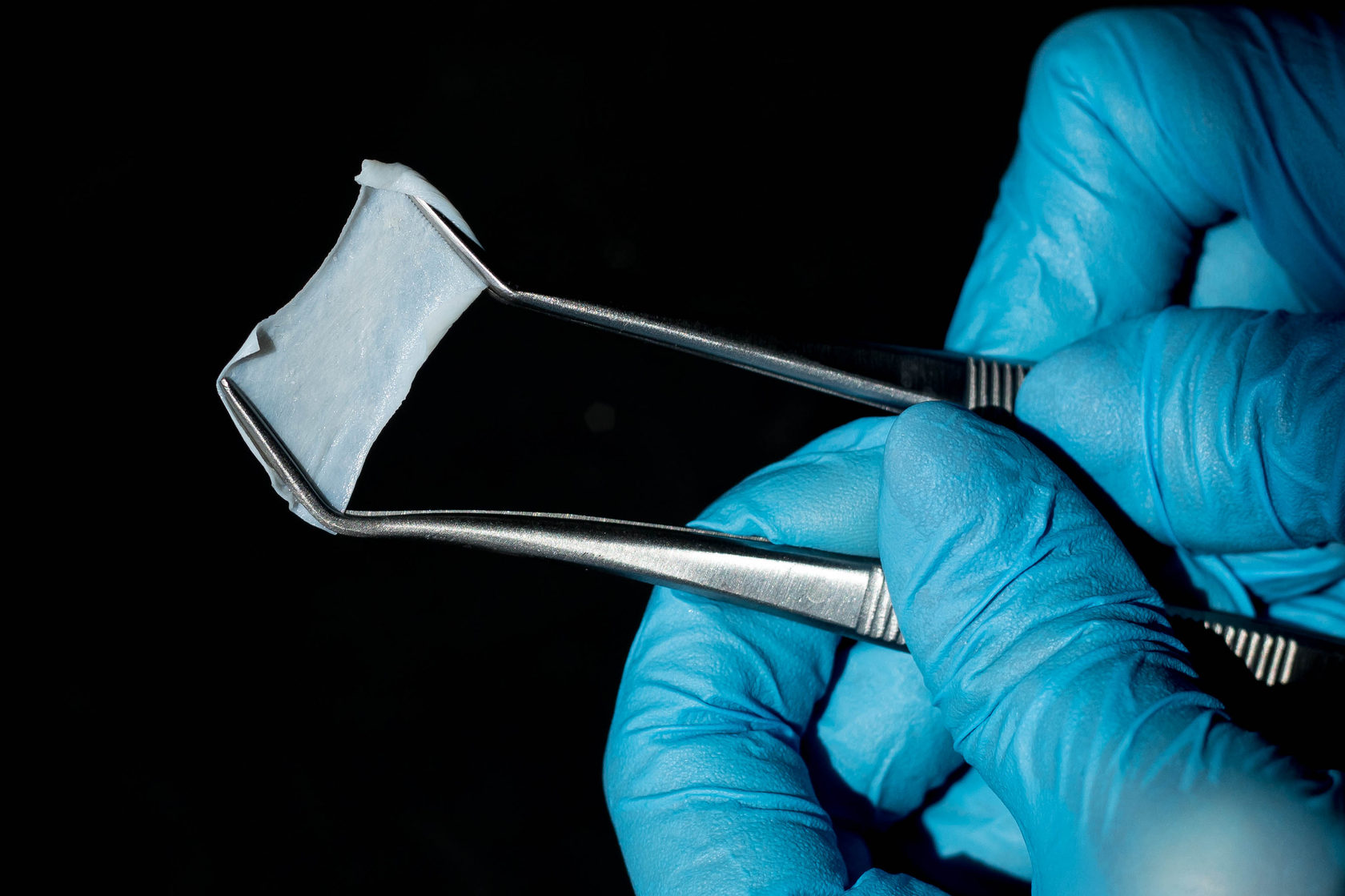 Bone Grafts, Collagen Membranes and Matrices for Dental Surgery