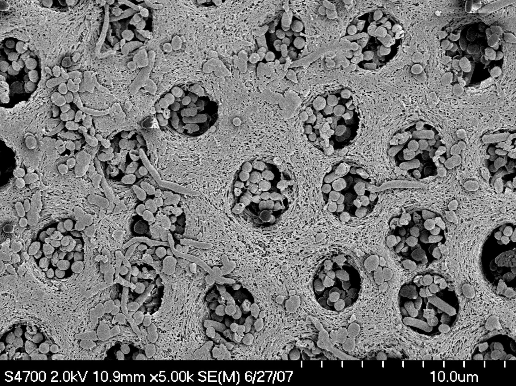 Update in endo 2023 by Dr. Markus Haapasalo