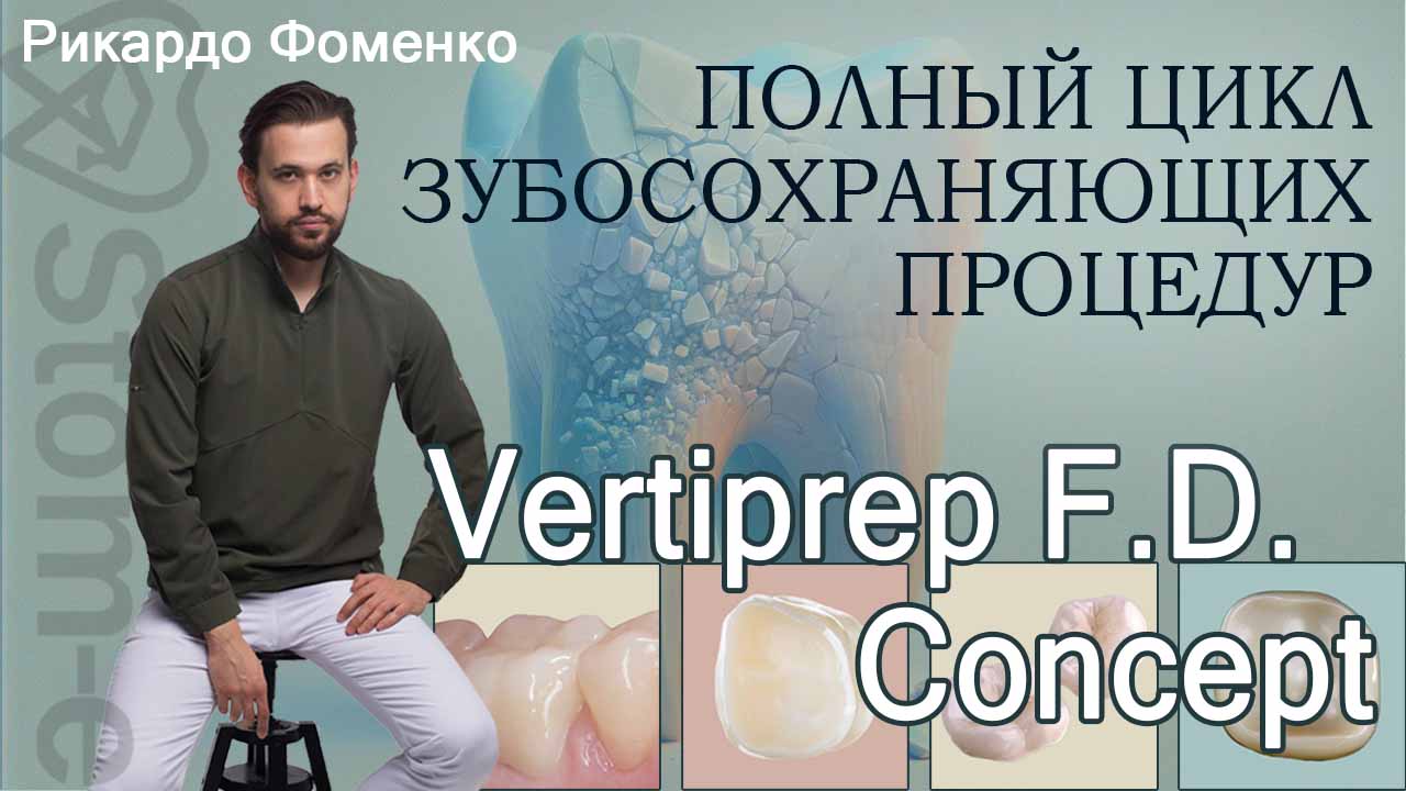 Курс по вертипреп (Vertiprep) | Рикардо Фоменко