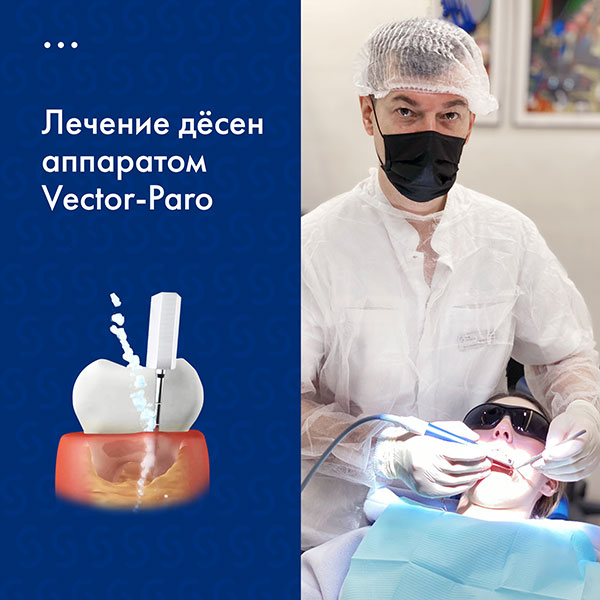 Лечение пародонтита апаратом Vector Paro - стоматология Time to Smile ...
