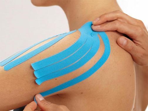 Тейпирование плечевого сустава: методы тейпирования области плеча ...