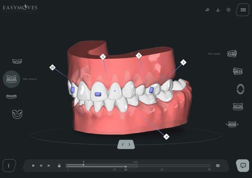 Dental 3D Viewer with your own Brand design. Fully adjustable and ...