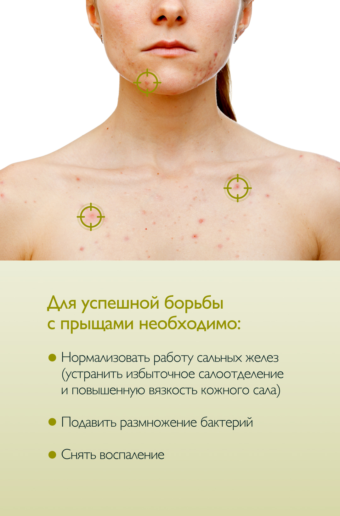 Циновит от угрей, прыщей и черных точек