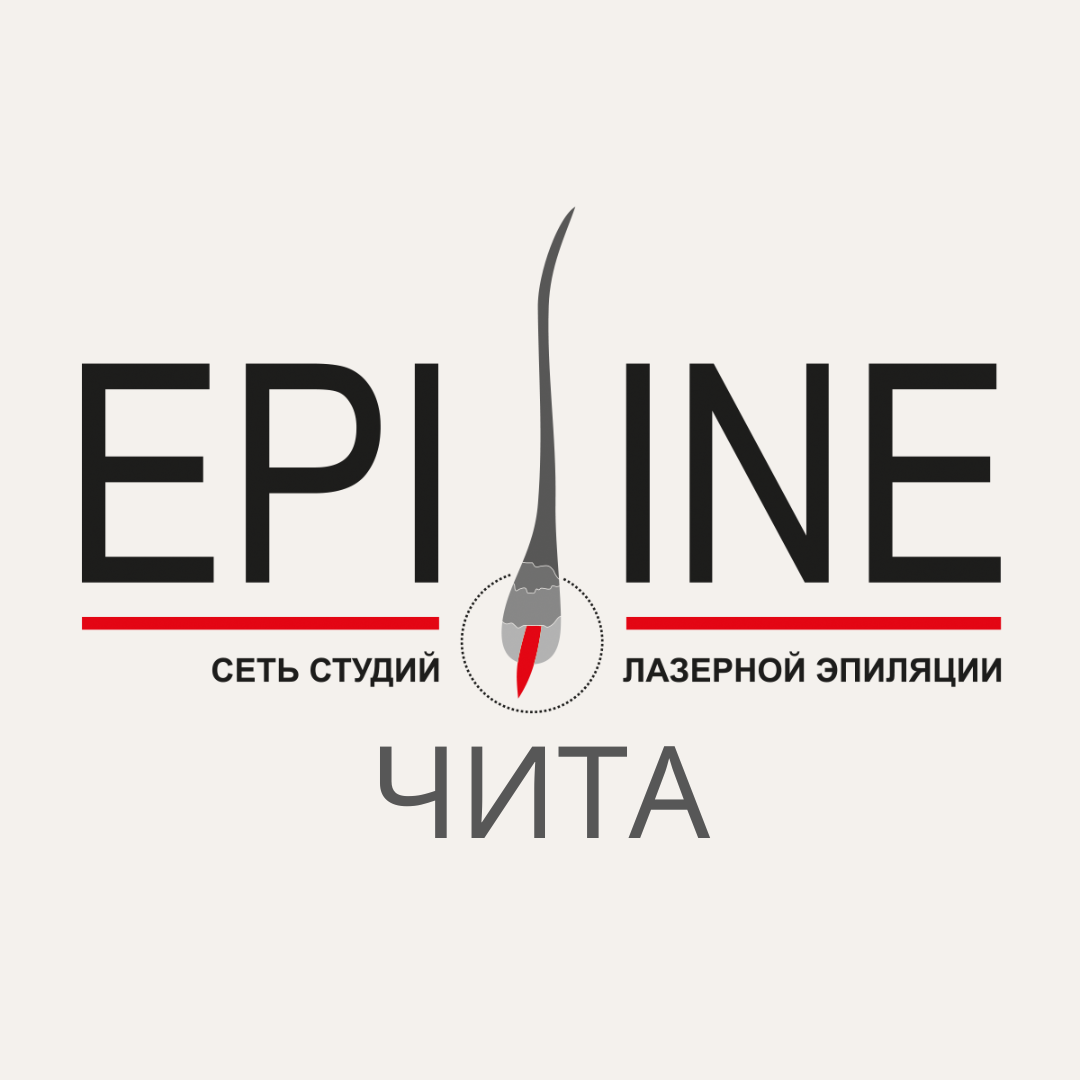 EPILINE – Чита